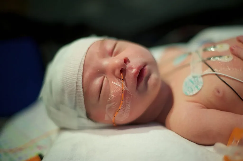 How Hypoxic-Ischemic Encephalopathy (HIE) Happens